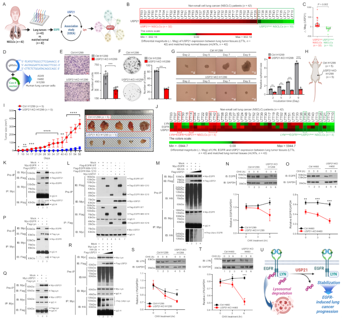 USP21-EGFR-Lyn轴驱动非小细胞肺癌进展及USP21抑制的治疗潜力-文献解析 - 生知库